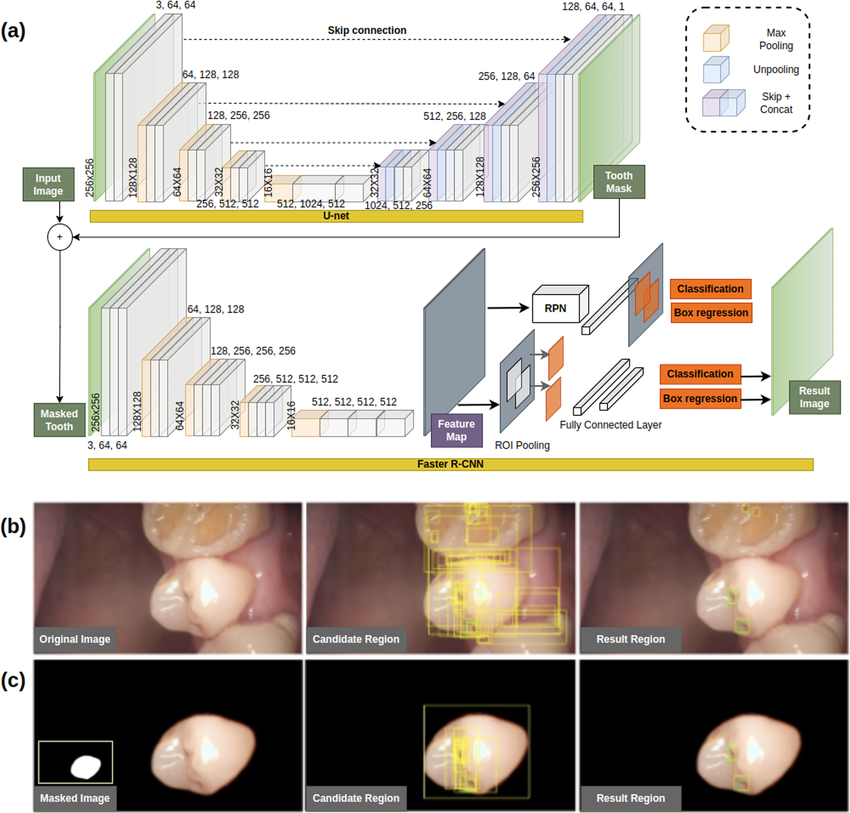 Real Time Tooth Caries And Cavity Detection Using Convolutional Neural Network Report Namma
